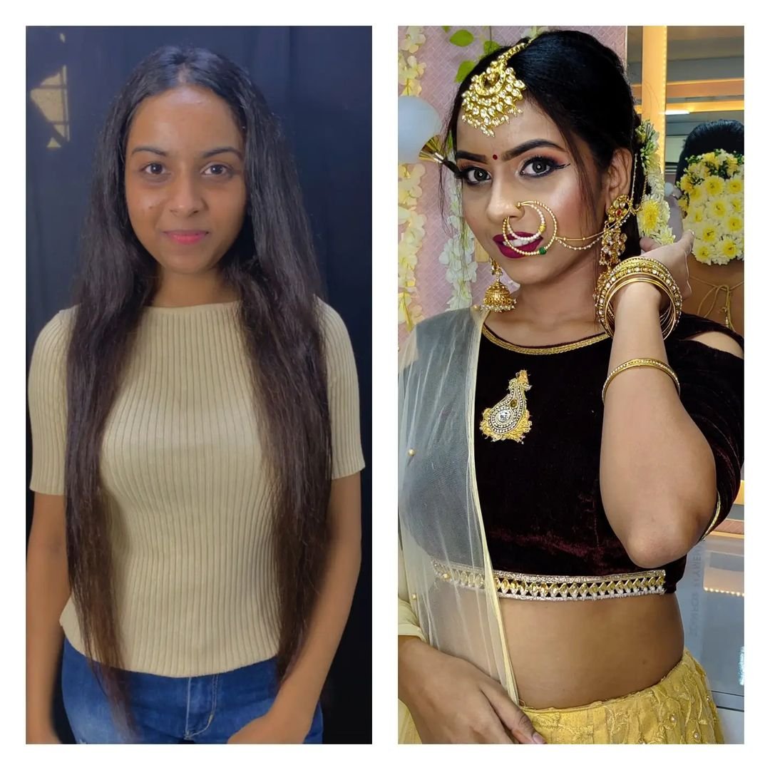 Gallery – Marvel Beauty Clinic